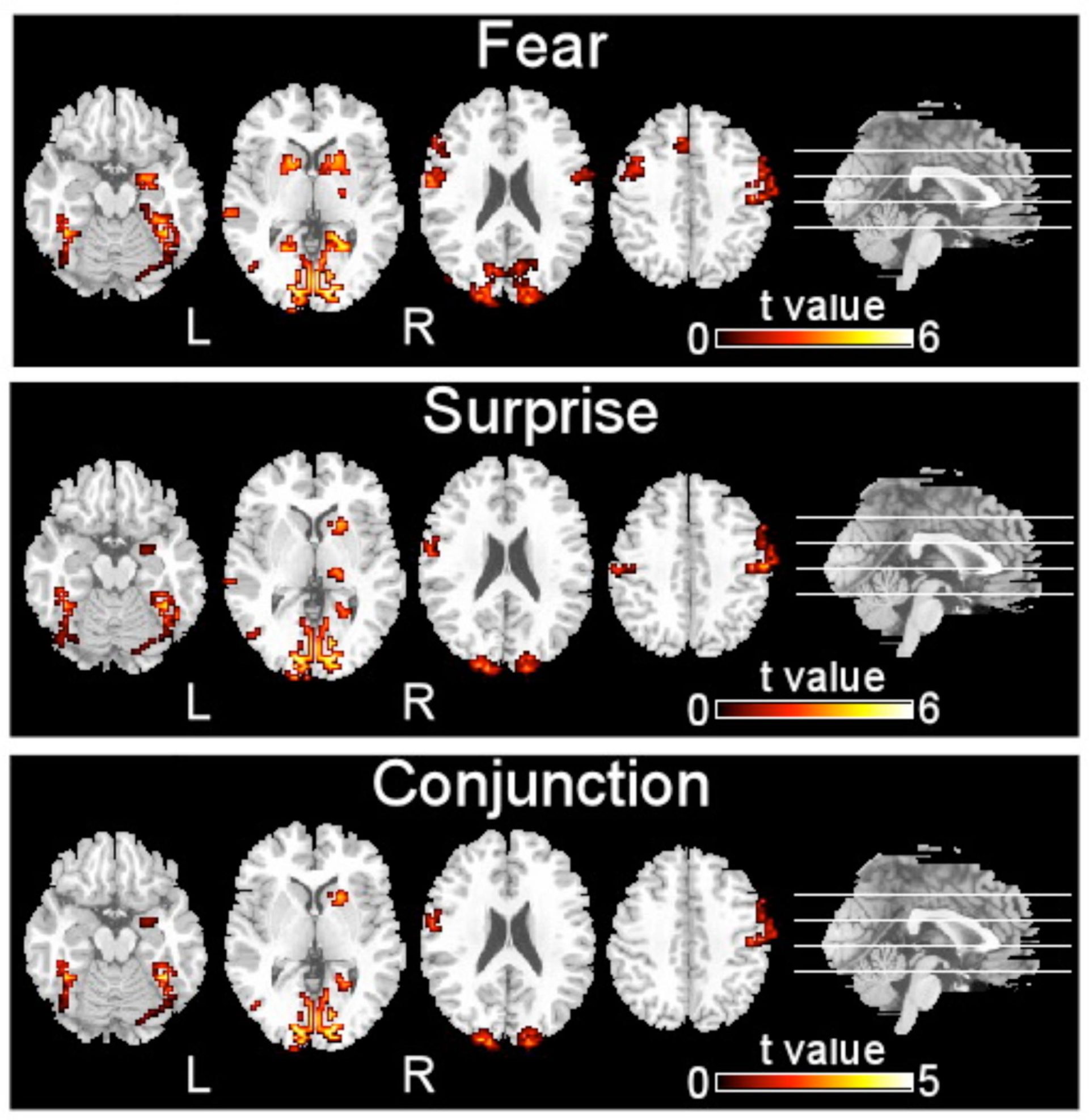The Neural Circuits Underlying Fear and Surprise - NHSJS