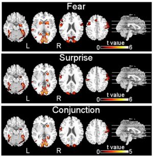 The Neural Circuits Underlying Fear and Surprise - NHSJS