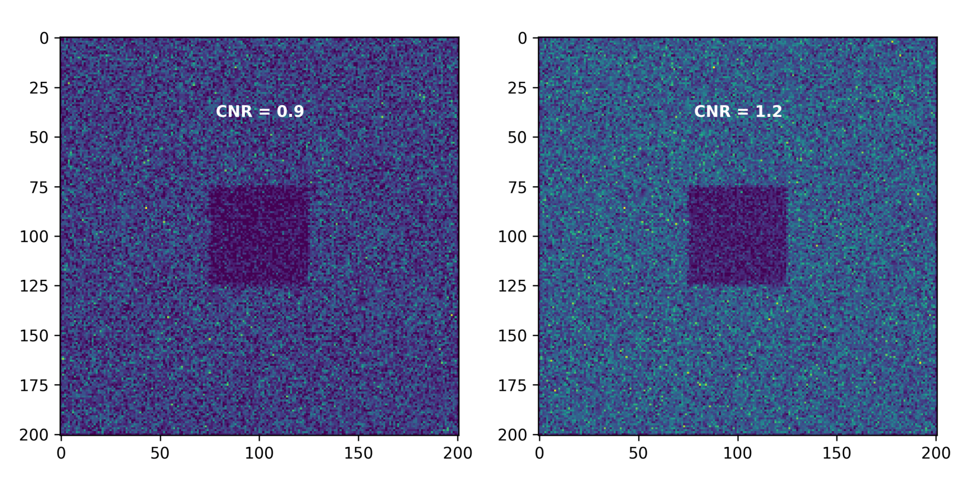 Improving Tumor Detection In X Ray Images Using Monte Carlo Simulation Based Optimization Nhsjs