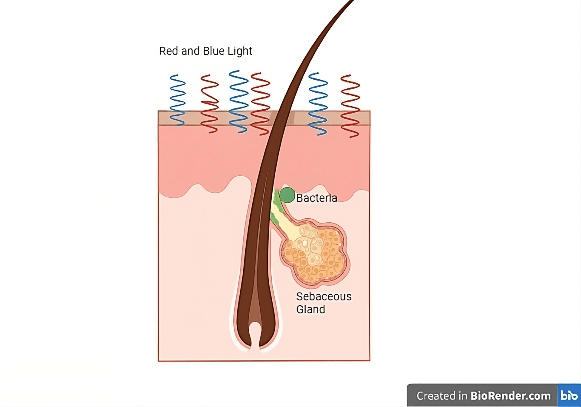 Balancing Acne: The Review of Psychological and Physical Therapies in ...