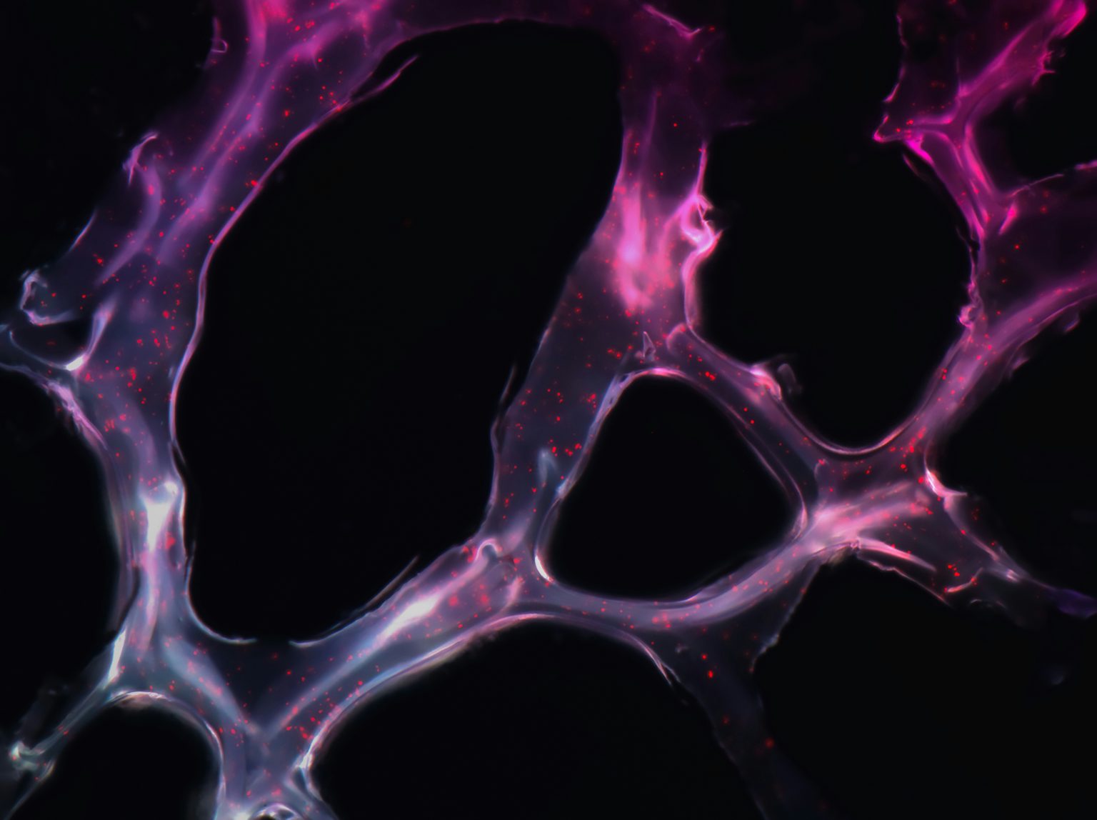 Gastric Cancer Genetic Profiles of the Inflammatory Pyroptosis Pathway ...