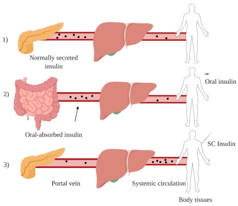Oral Insulin: A Promising Frontier in Diabetes Therapy - NHSJS